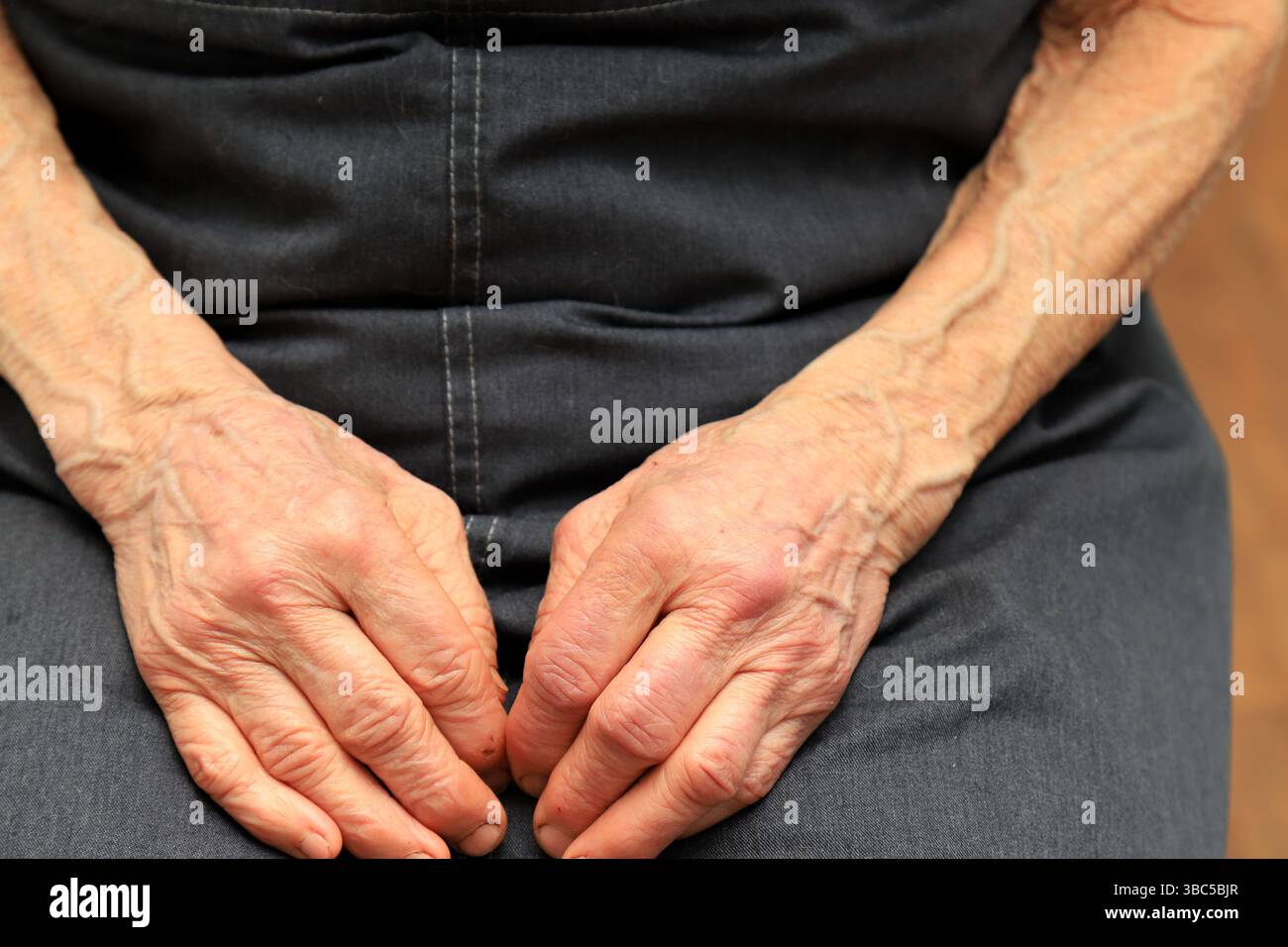 Hands of an old woman pensioner with varicose veins, arthritis ...
