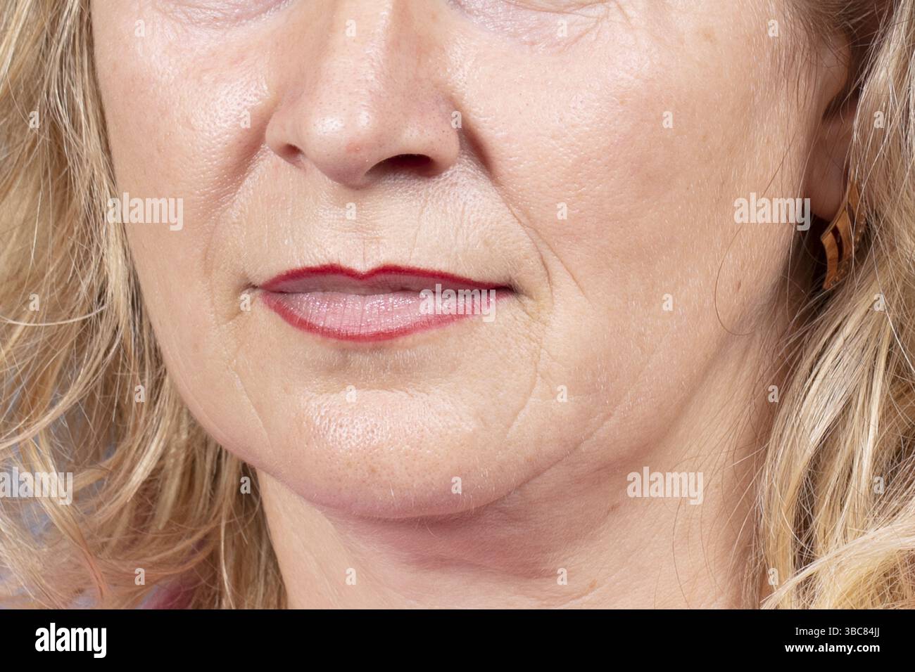 The lower part of the face and neck of an older woman with signs of ...