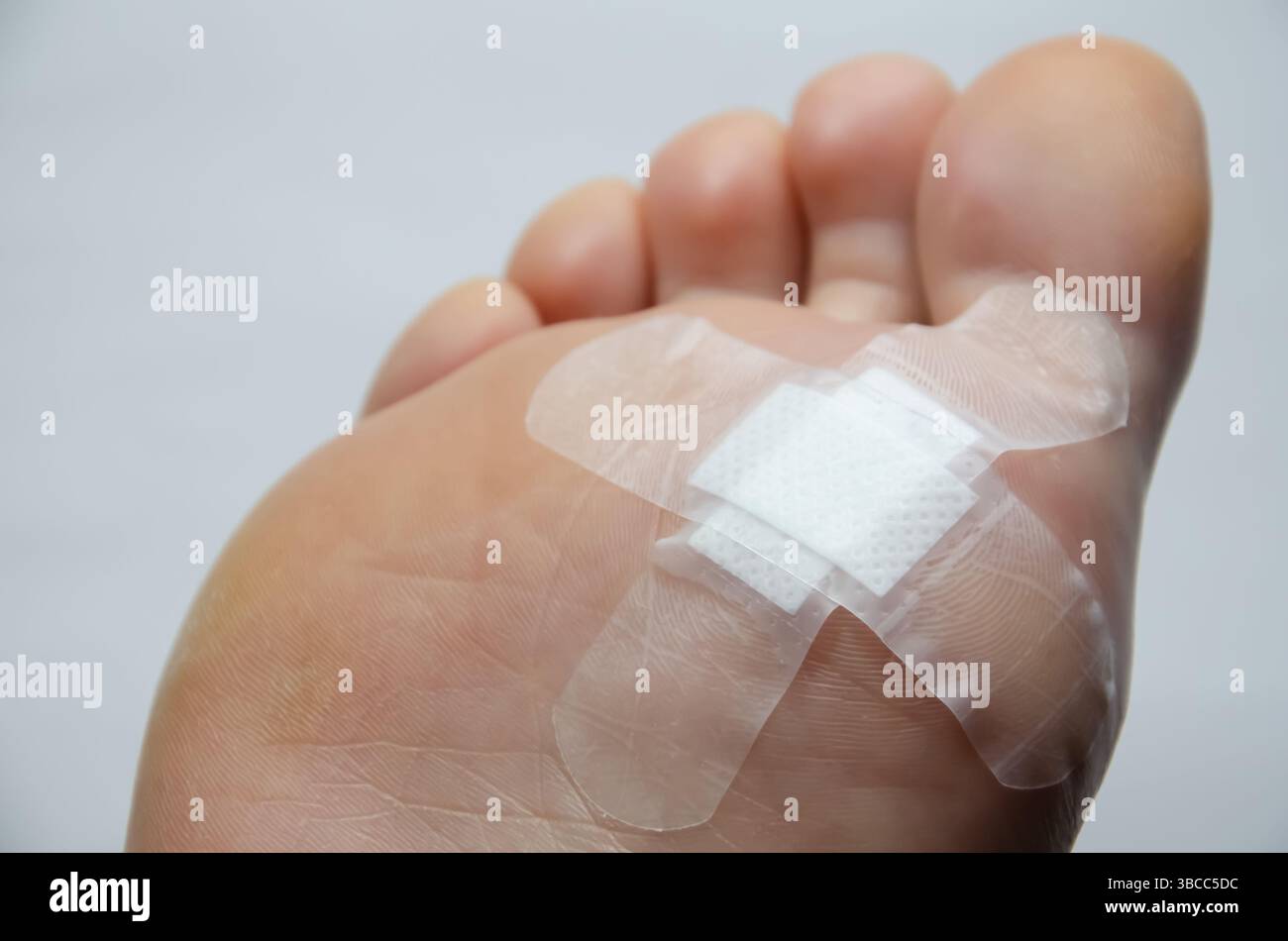 Verruca feet woman hi-res stock photography and images - Alamy