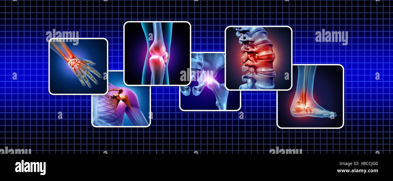 Human Joints Pain concept as skeleton and muscle anatomy of the body ...