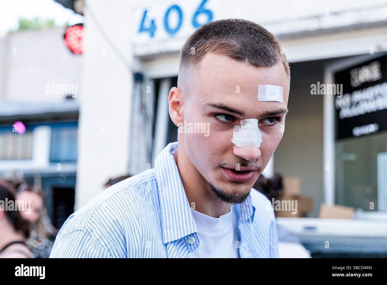Tim Lemperle (1. FC K?ln, 19) mit Gesichtsverletzungen, Pflaster 2. Fu ...