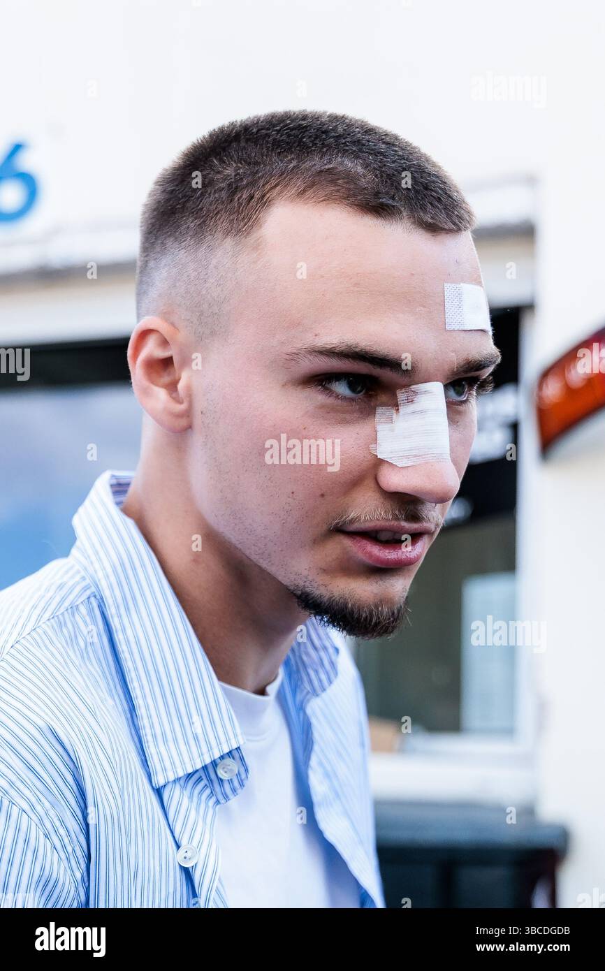 Tim Lemperle (1. FC K?ln, 19), Gesichtsverletzungen, Pflaster 2. Fu ...