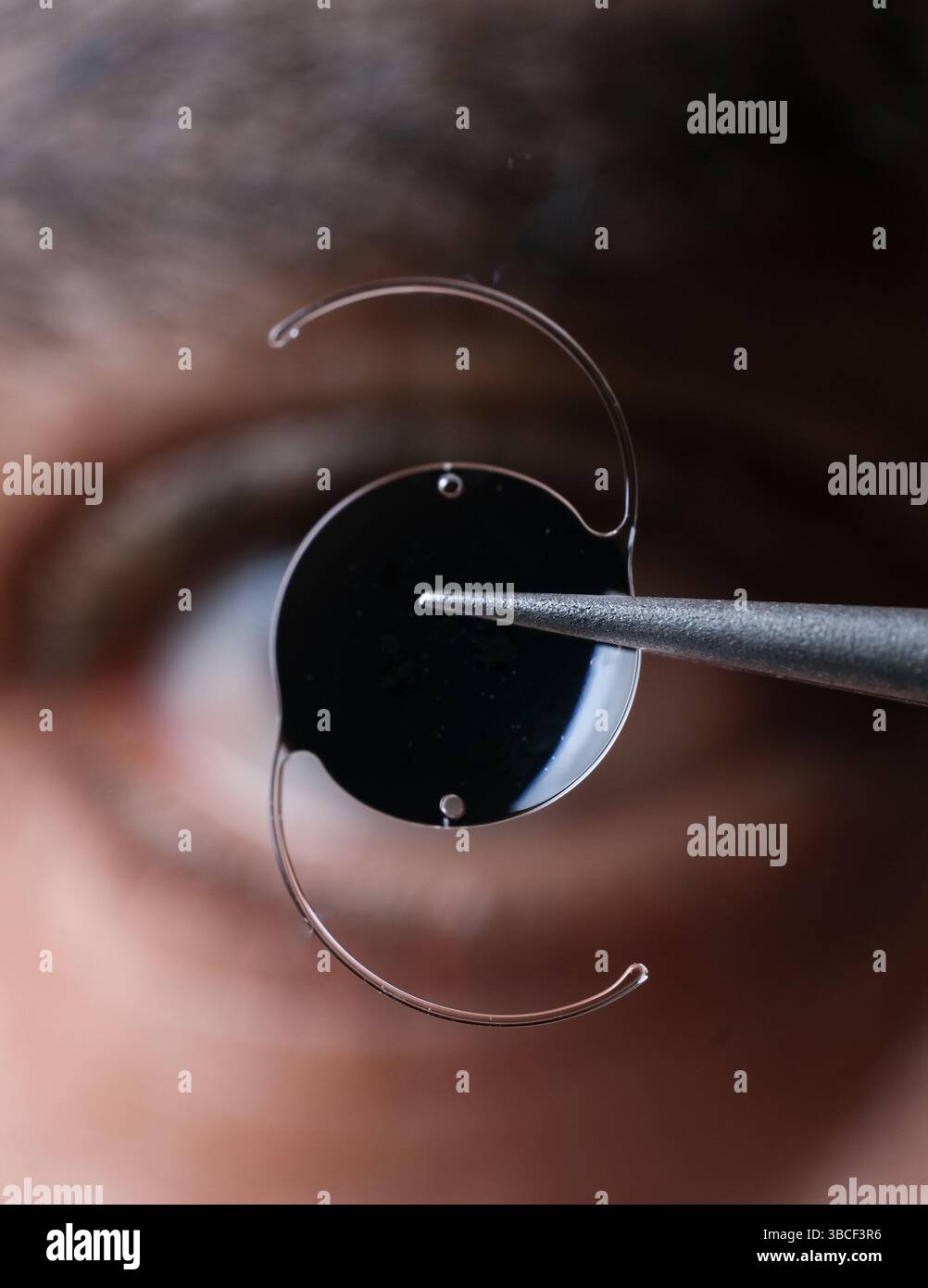 Phako hi-res stock photography and images - Alamy