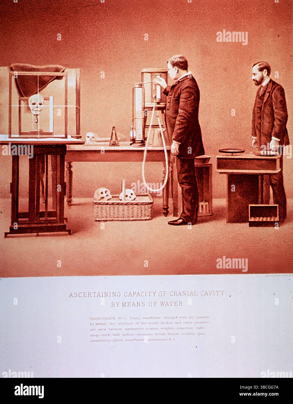 Ascertaining Capacity of Cranial Cavity by Means of Water Photograph No ...