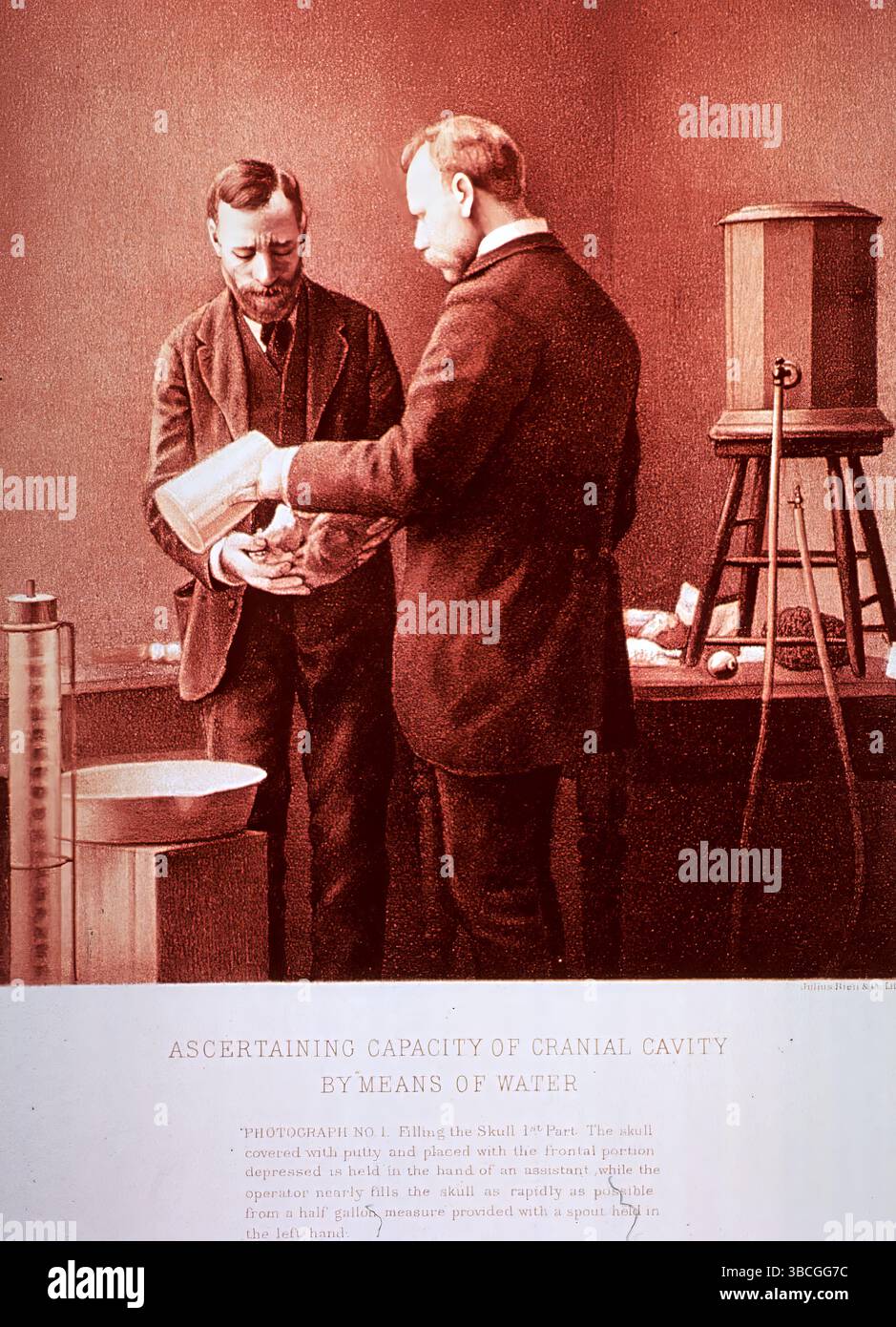 Ascertaining Capacity of Cranial Cavity by Means of Water Photograph No ...