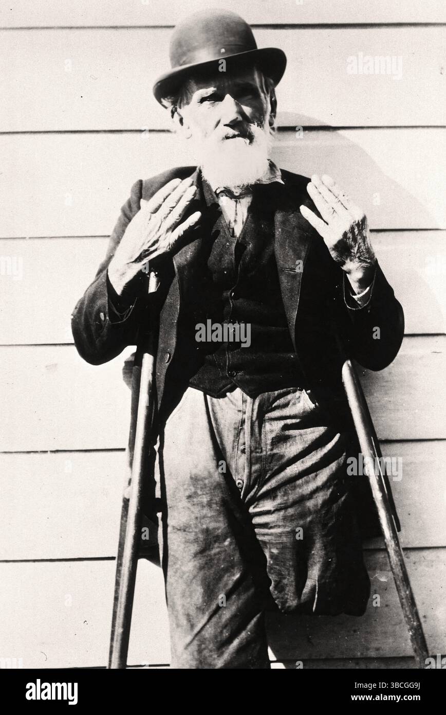 Male Plague Victim (Three-Quarter Length Portrait, Facing Front) On ...
