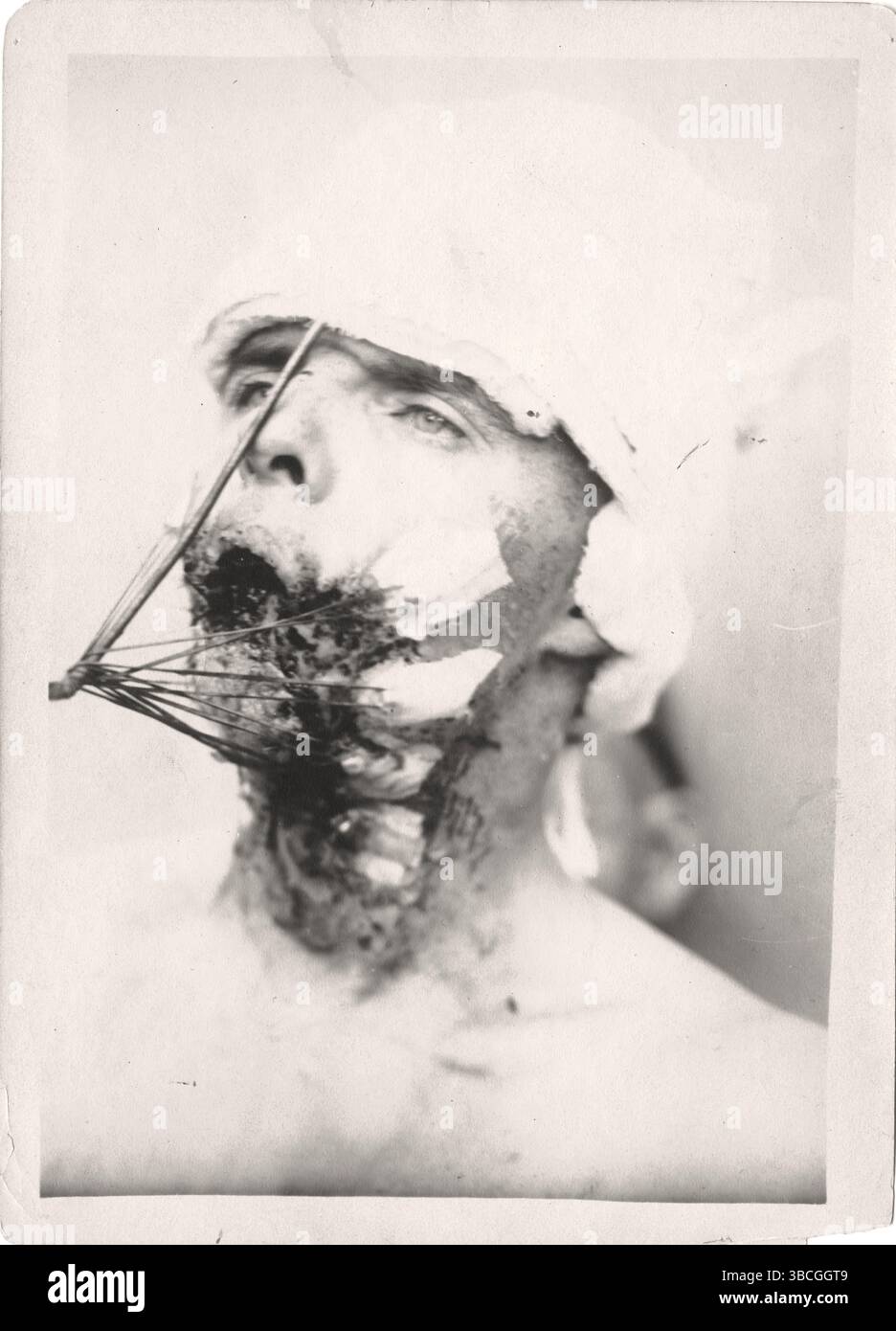 Medicine in Wartime - Soldier facial injuries 35 Stock Photo - Alamy