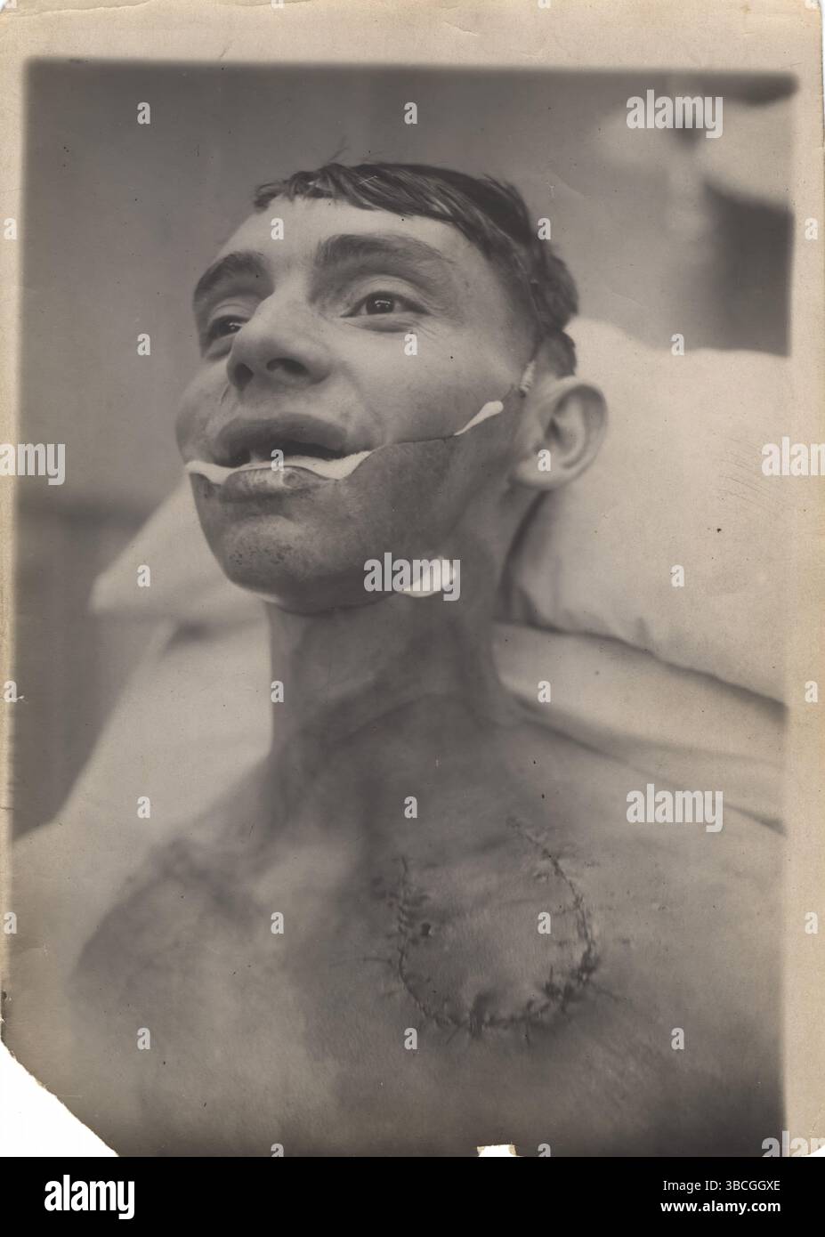 Soldier facial injuries 1 - Historical document, photographer unknow ...