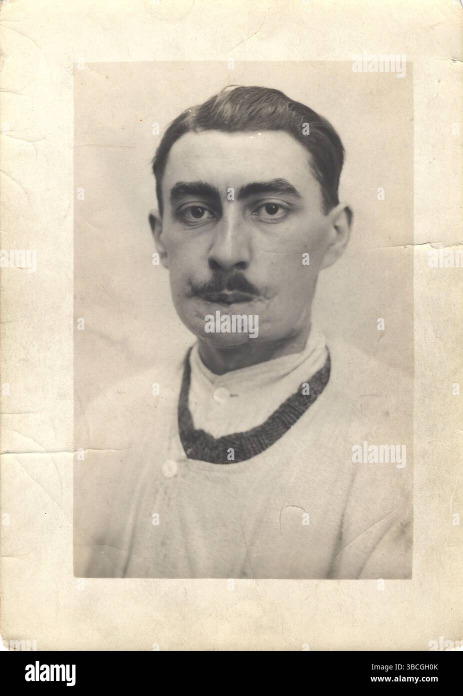 Soldier facial injuries 23] - Historical document, photographer unknow ...