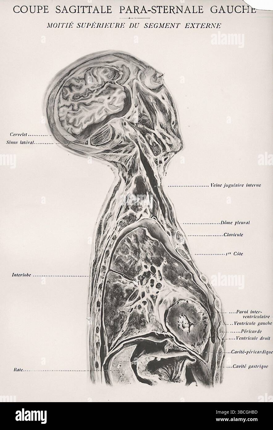 Coupe sagittale para-sternale gauche, moitié supérieure du segment ...