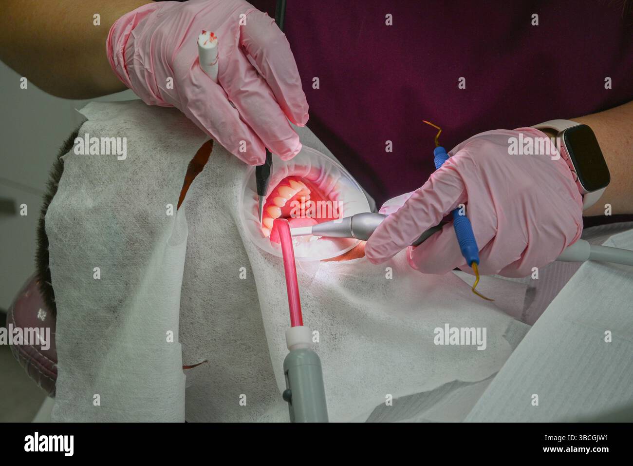 Dentist working on patient's teeth using dental instruments and wearing ...