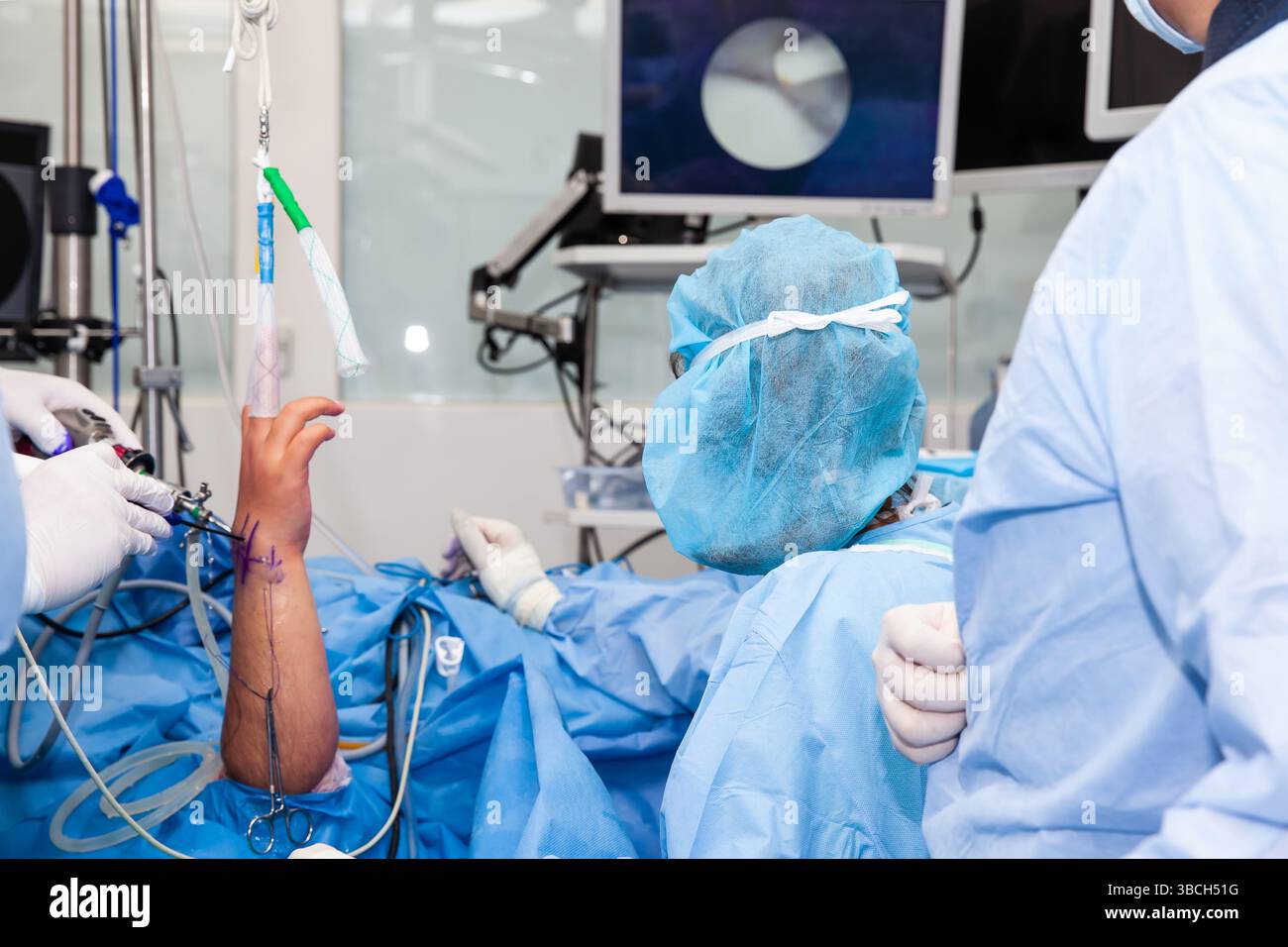 Group of orthopedic surgeons performing a wrist arthroscopy on a male ...