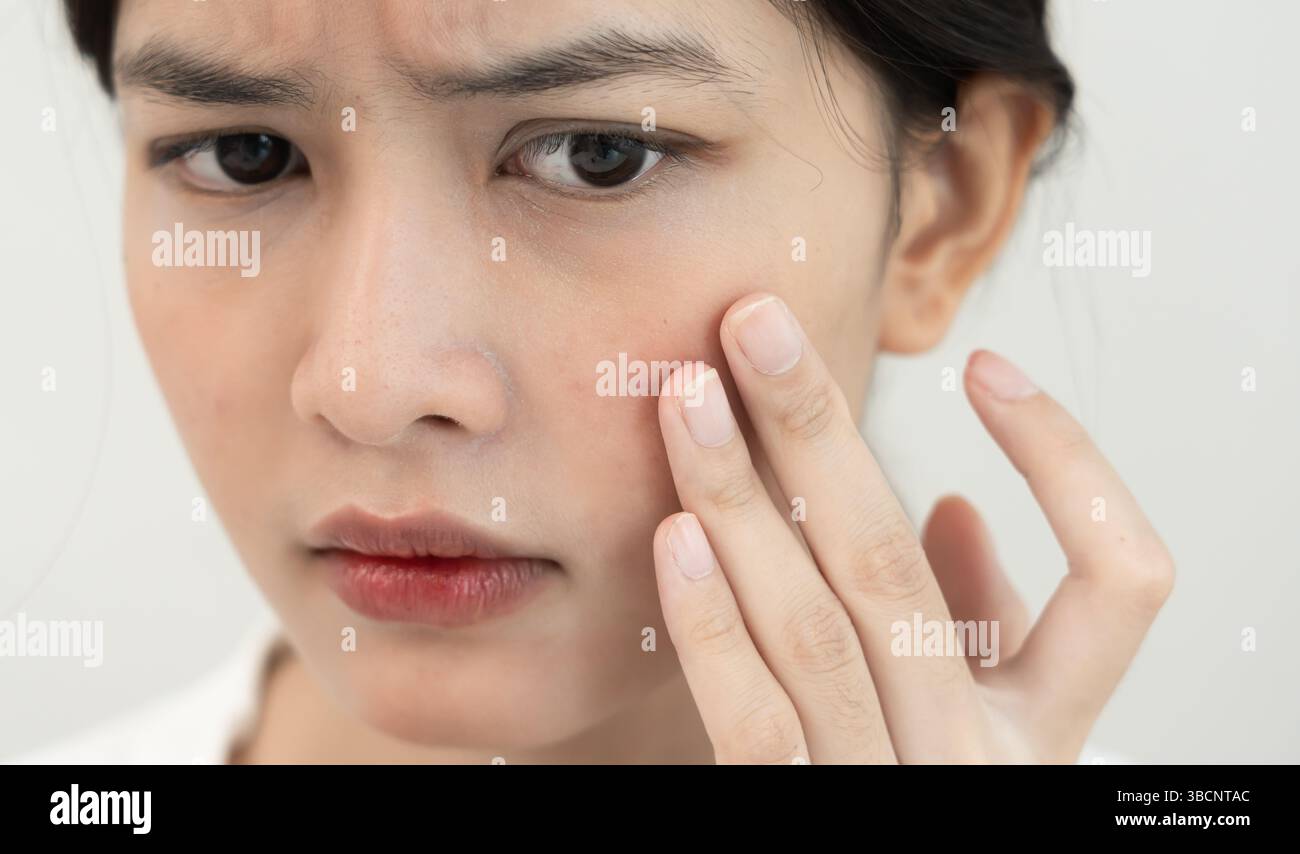 Woman worried about face Dermatology, rosacea dermatitis, allergic ...