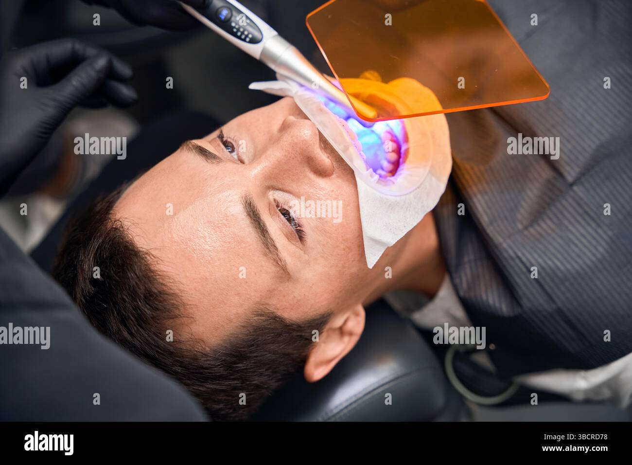 Dentist placing filling to male patient tooth and using LED dental lamp ...