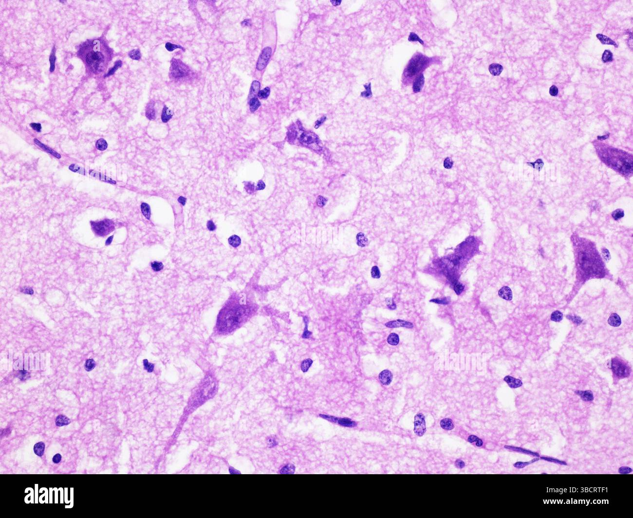 Histology of Human Brain Tissue Viewed at 400x Magnification with ...