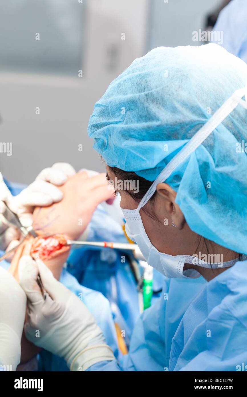 Female doctor performing a surgery. Orthopedic surgeon. Surgery and ...