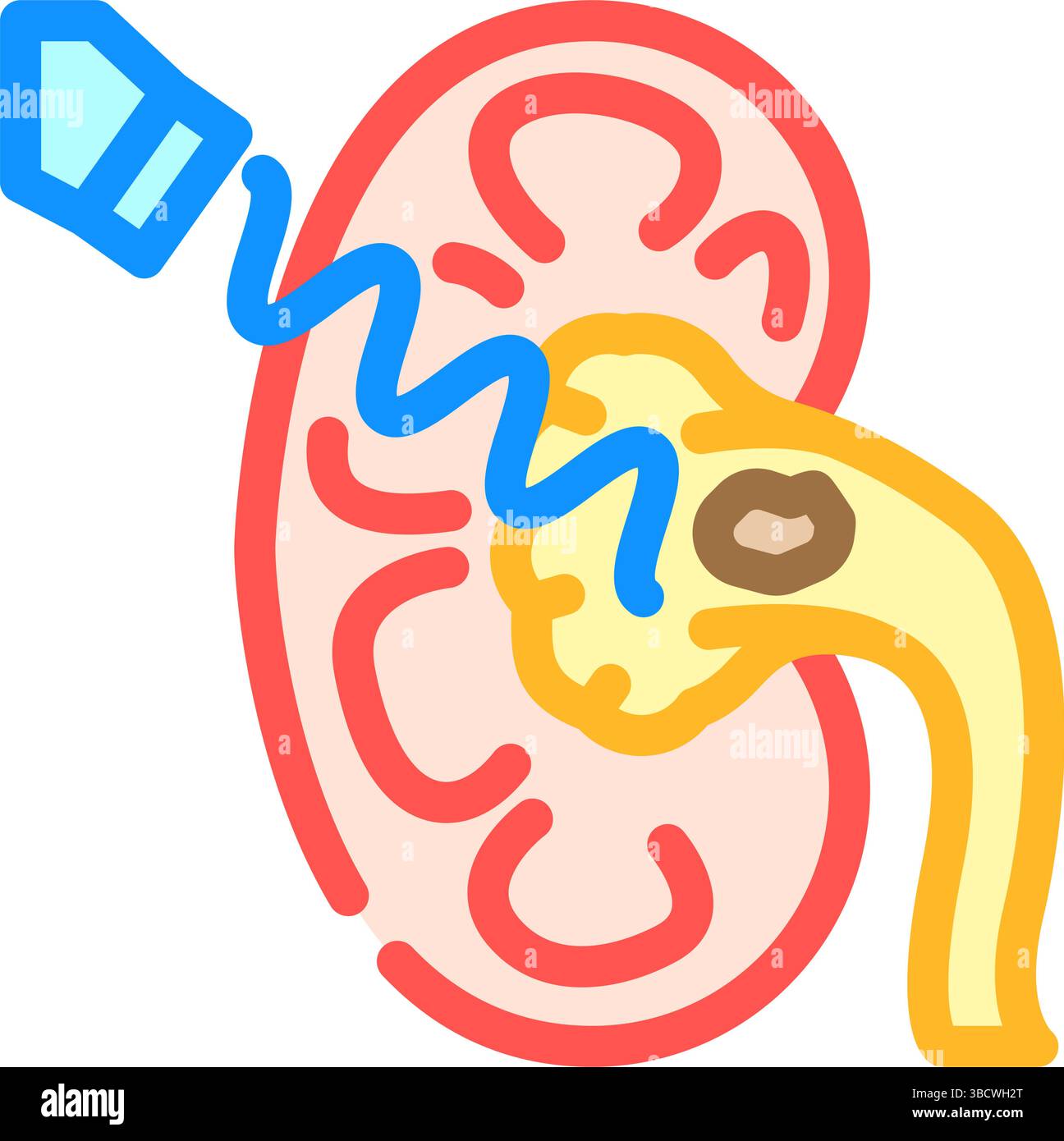 Varicocele hi-res stock photography and images - Alamy