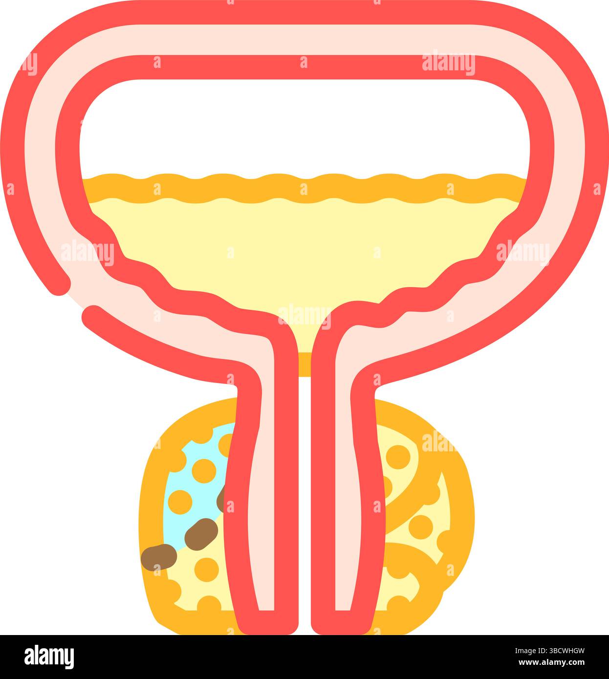 prostatectomy urology color icon vector illustration Stock Vector Image ...