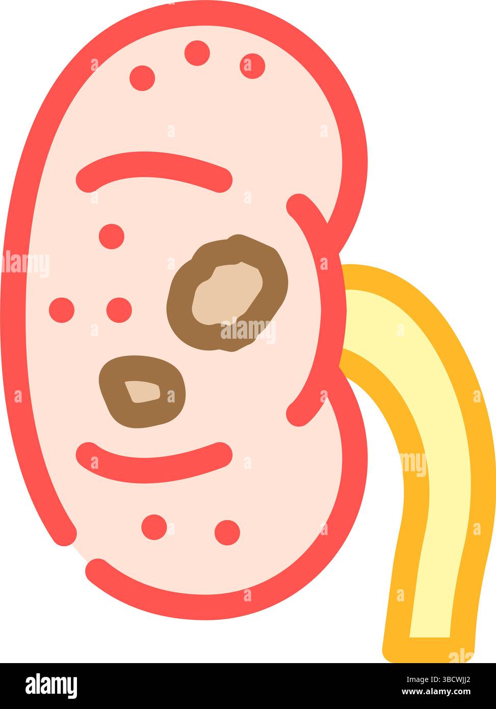 urolithiasis urology color icon vector illustration Stock Vector Image ...