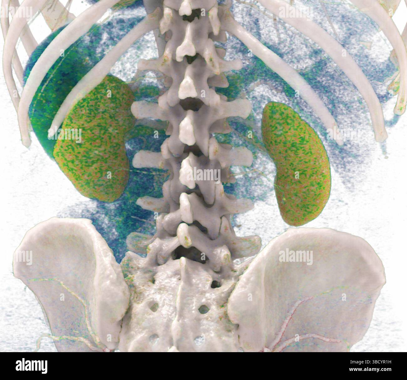 Coloured 3D computed tomography (CT) angiogram scan of a healthy abdominal cavity showing the ...