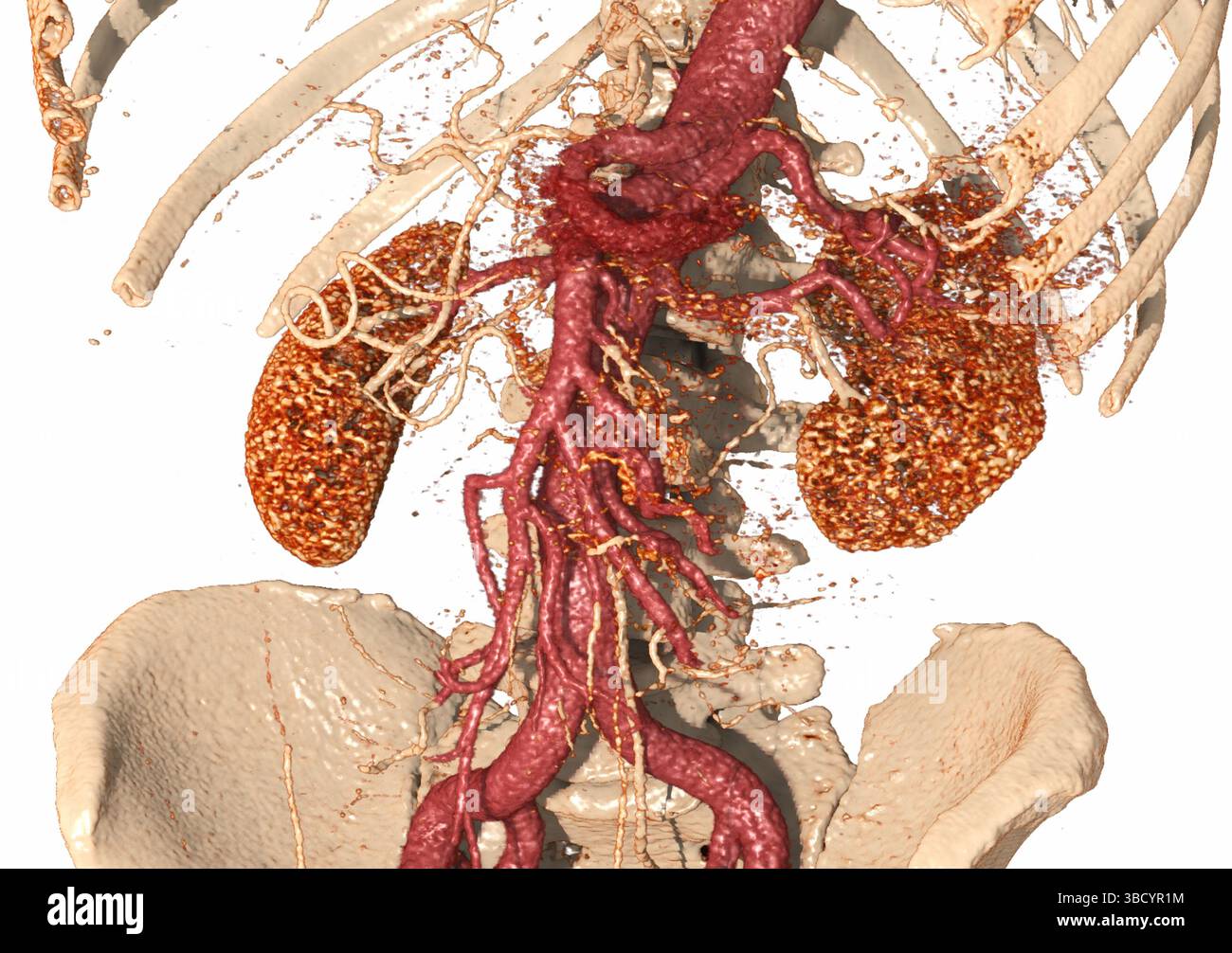 Coloured 3D computed tomography (CT) angiogram scan of a normal abdominal cavity showing the ...