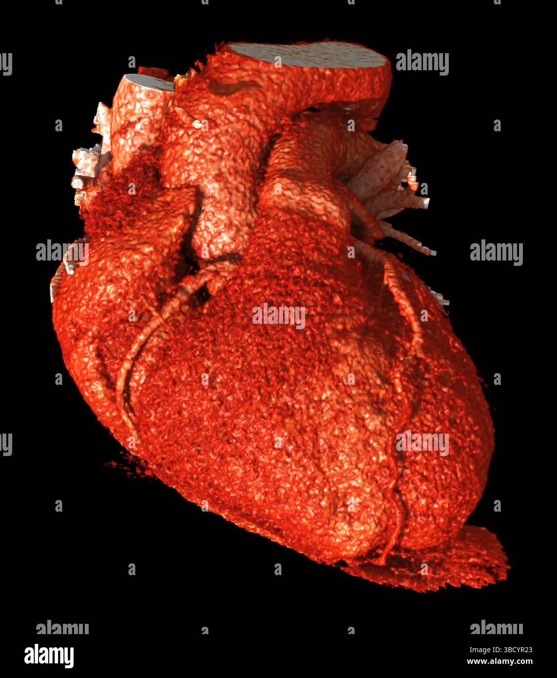 Coloured 3D computed tomography (CT) angiogram scan of a healthy heart ...