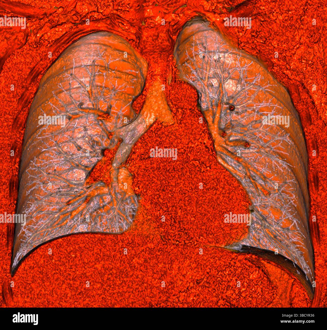 Coloured 3D computed tomography (CT) scan of healthy lungs, showing the main bronchi (pink) and ...