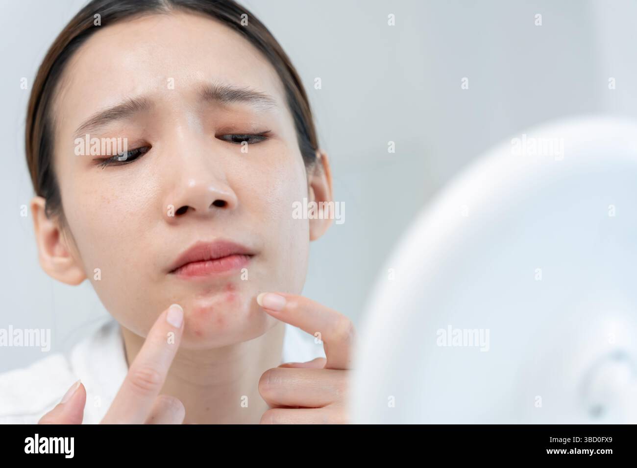 Woman worried about face Dermatology, rosacea dermatitis, allergic ...