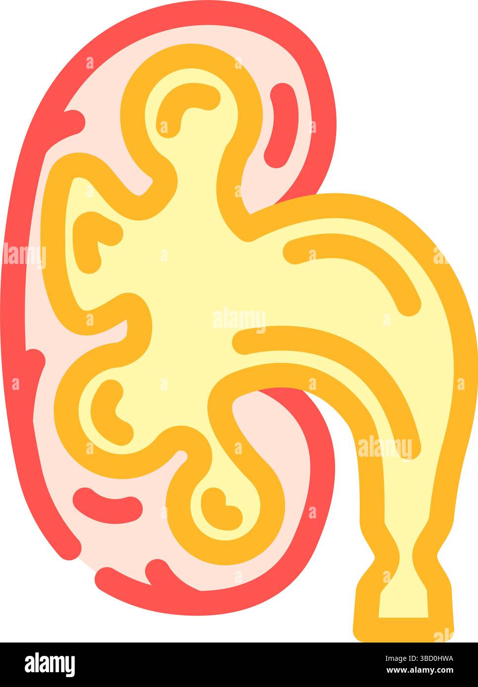 hydronephrosis urology color icon vector illustration Stock Vector ...