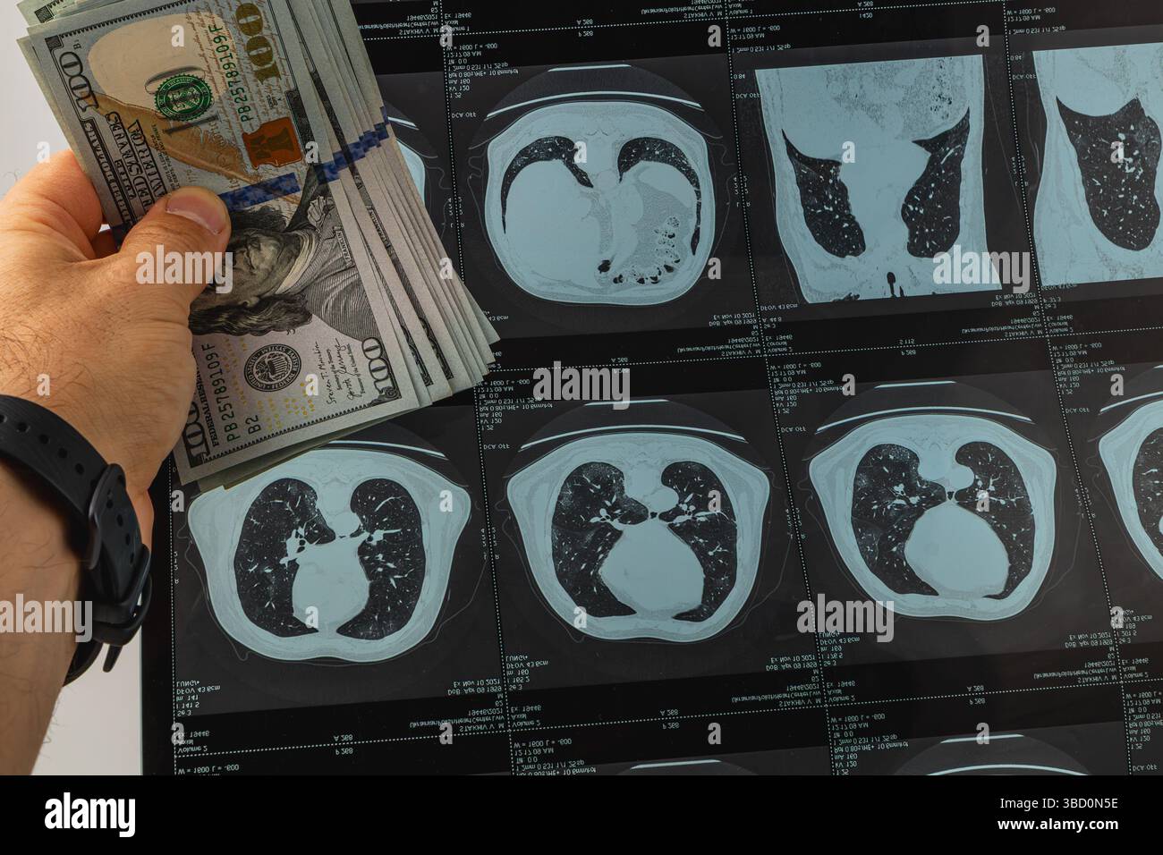 A hand with a stack of cash is positioned above a set of medical ...