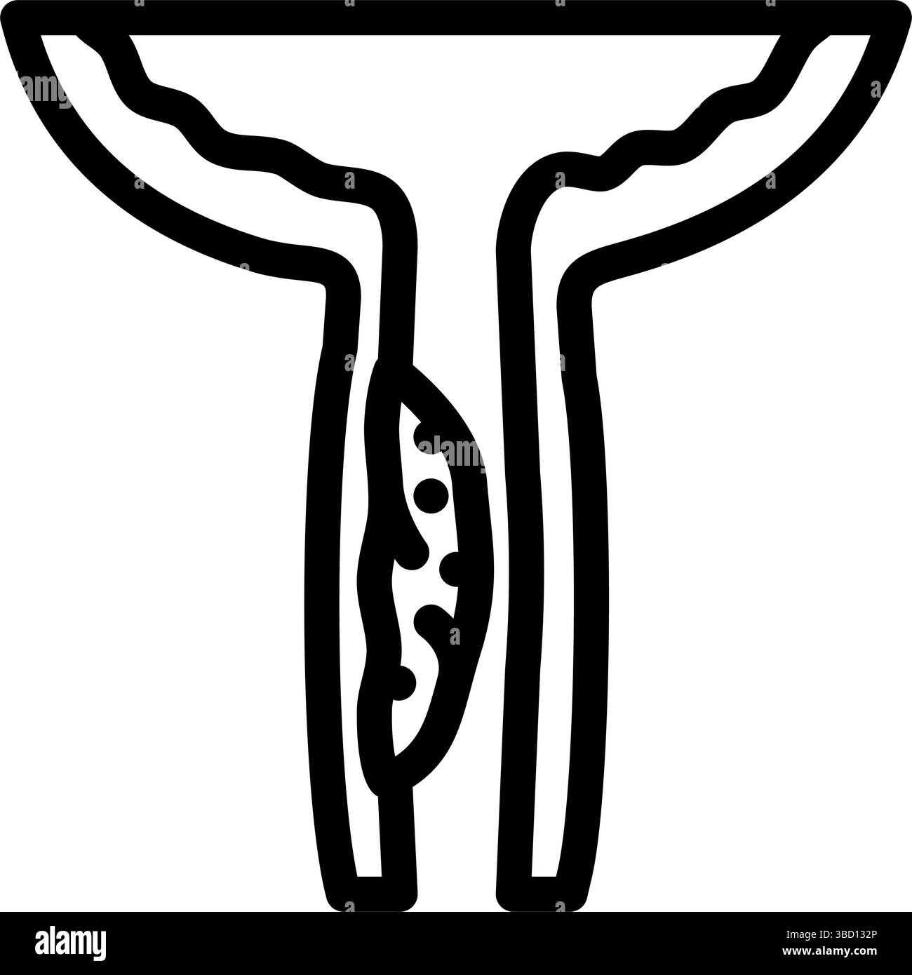 urethral stricture urology line icon vector illustration Stock Vector ...