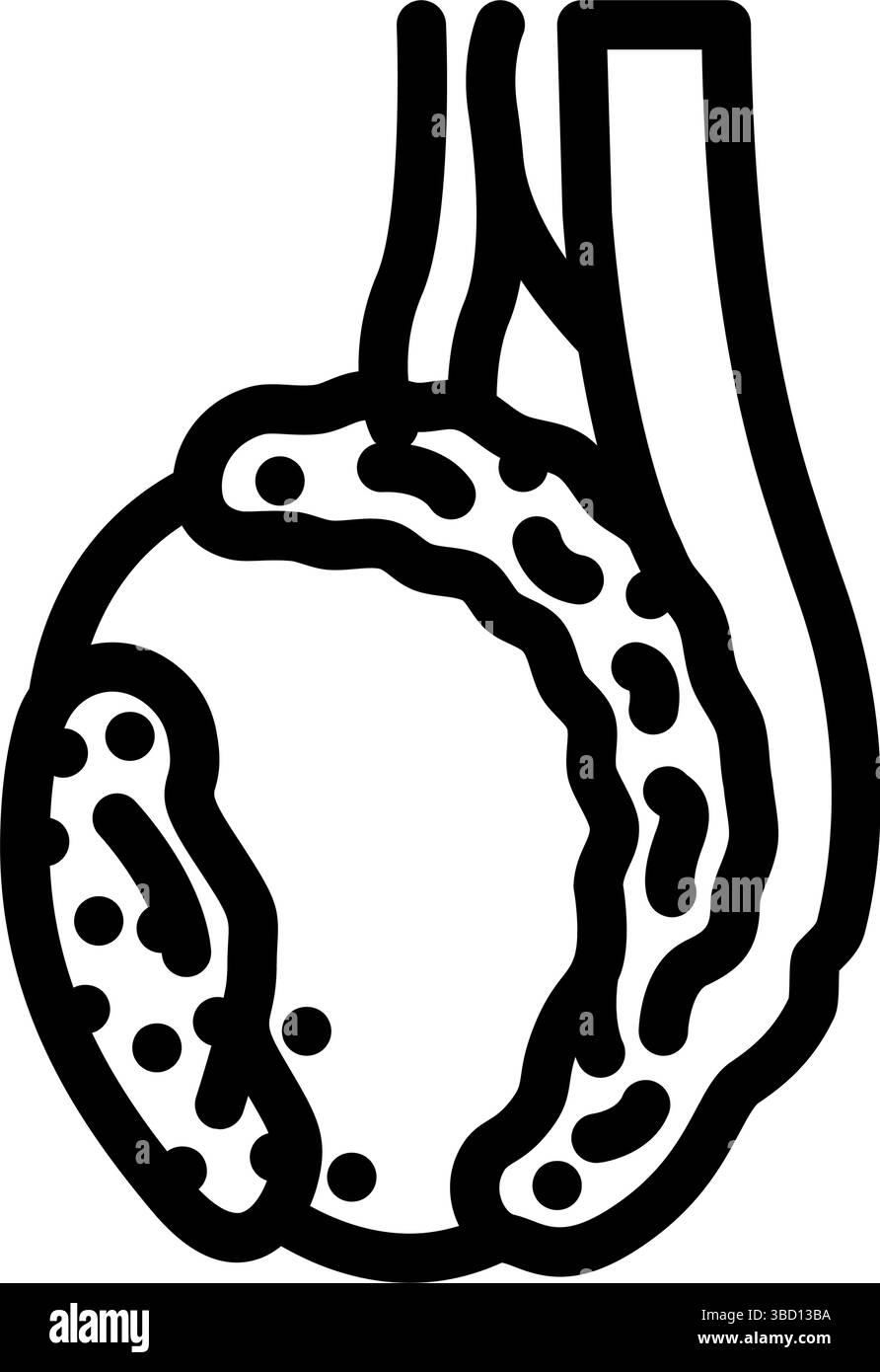 testicular cancer urology line icon vector. testicular cancer urology ...