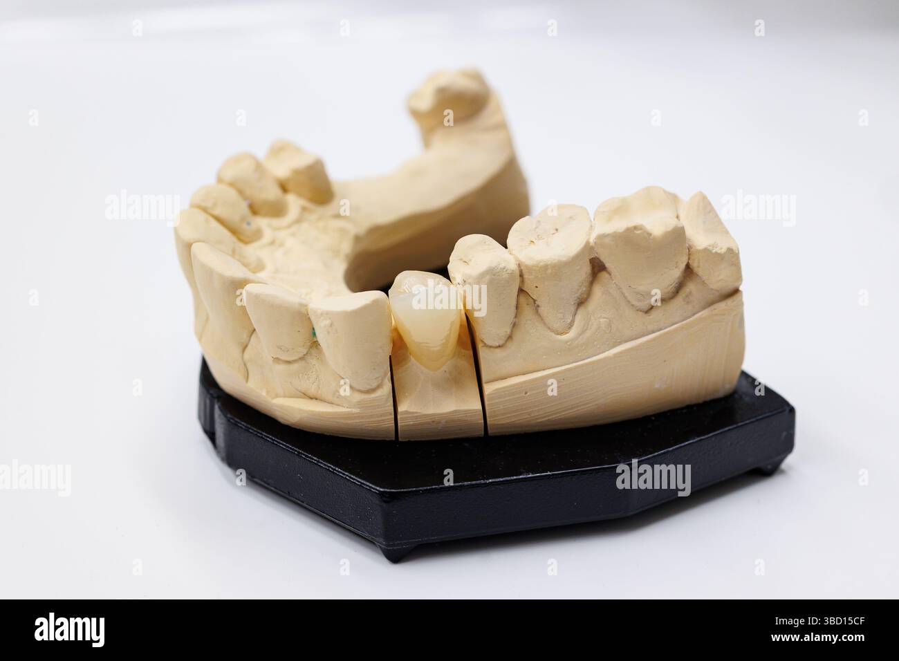 Dental stone model of lower jaw for prosthetic work Stock Photo - Alamy