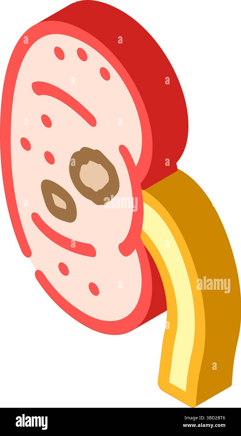 urolithiasis urology isometric icon vector illustration Stock Vector ...