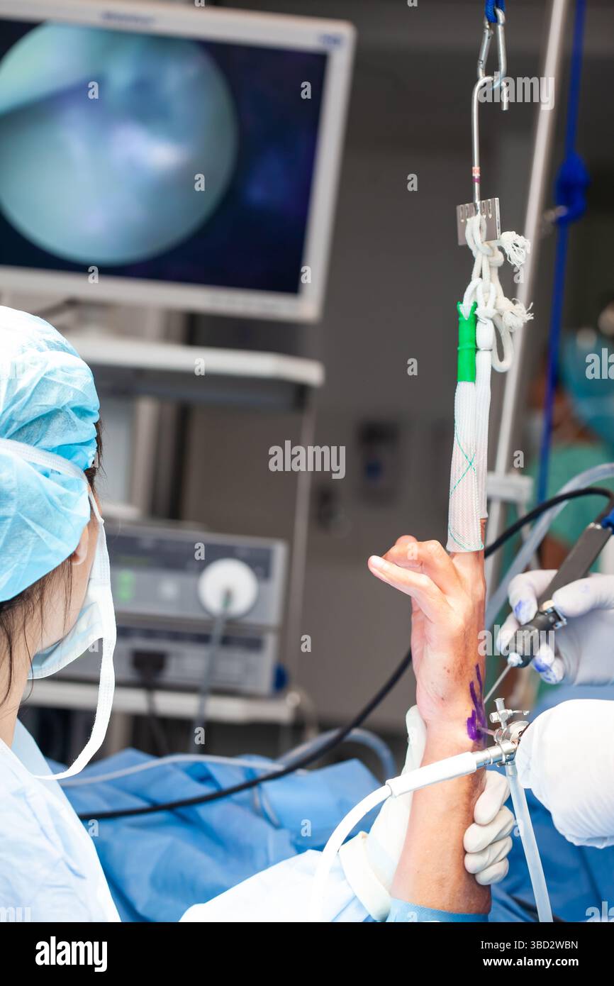 Group of orthopedic surgeons performing a wrist arthroscopy on a male ...