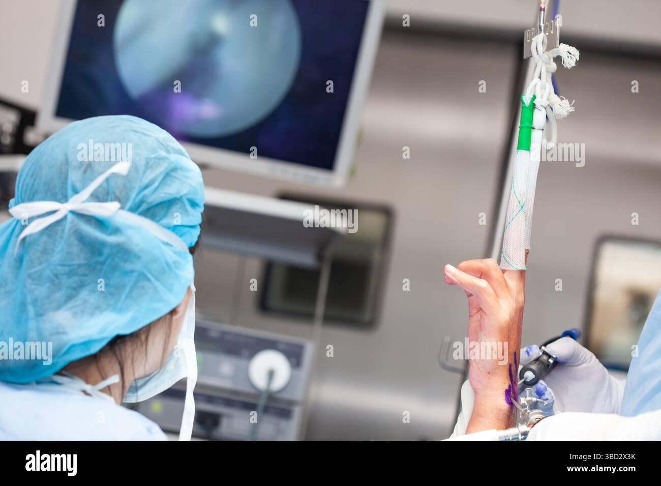 Group of orthopedic surgeons performing a wrist arthroscopy on a male ...