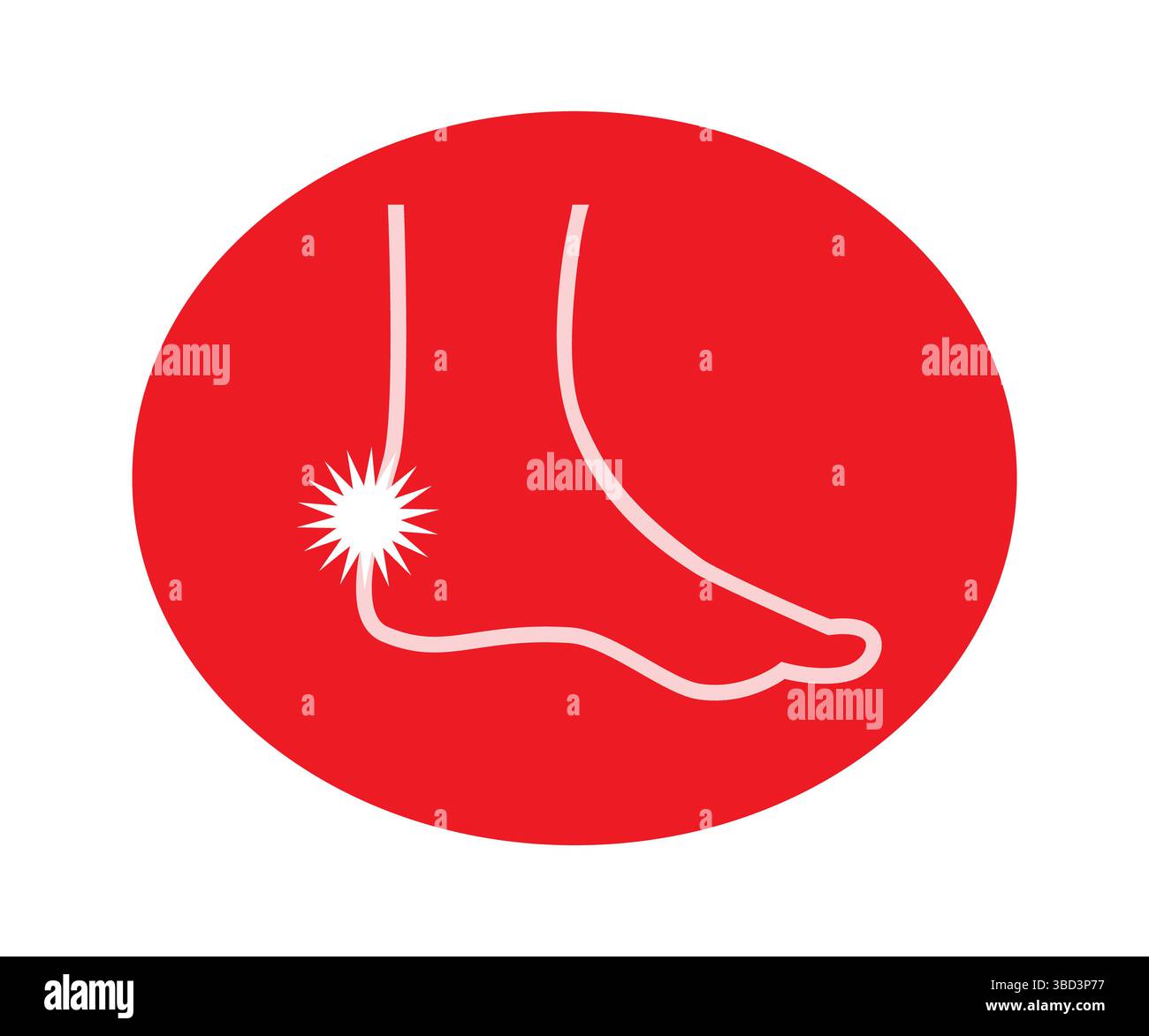 Foot pain in achilles tendon, Achilles tendonitis line art illustration ...