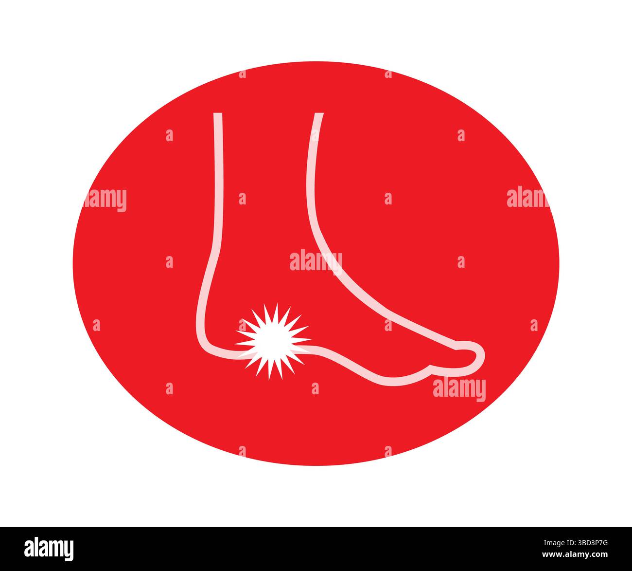 Foot pain line art illustration, Plantar Fasciitis Stock Photo - Alamy