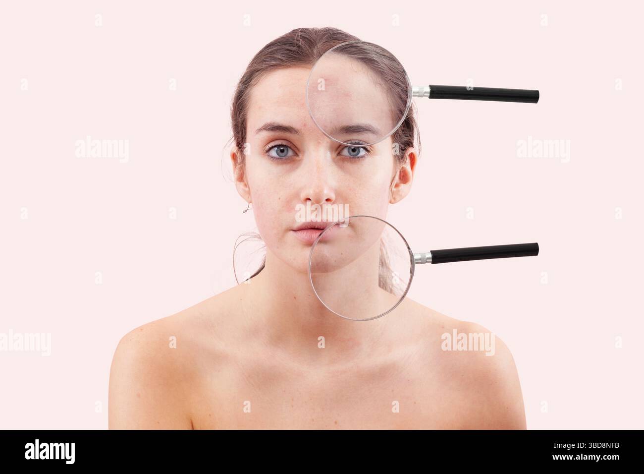 Portrait of woman with no makeup, real skin with acne and blemishes ...