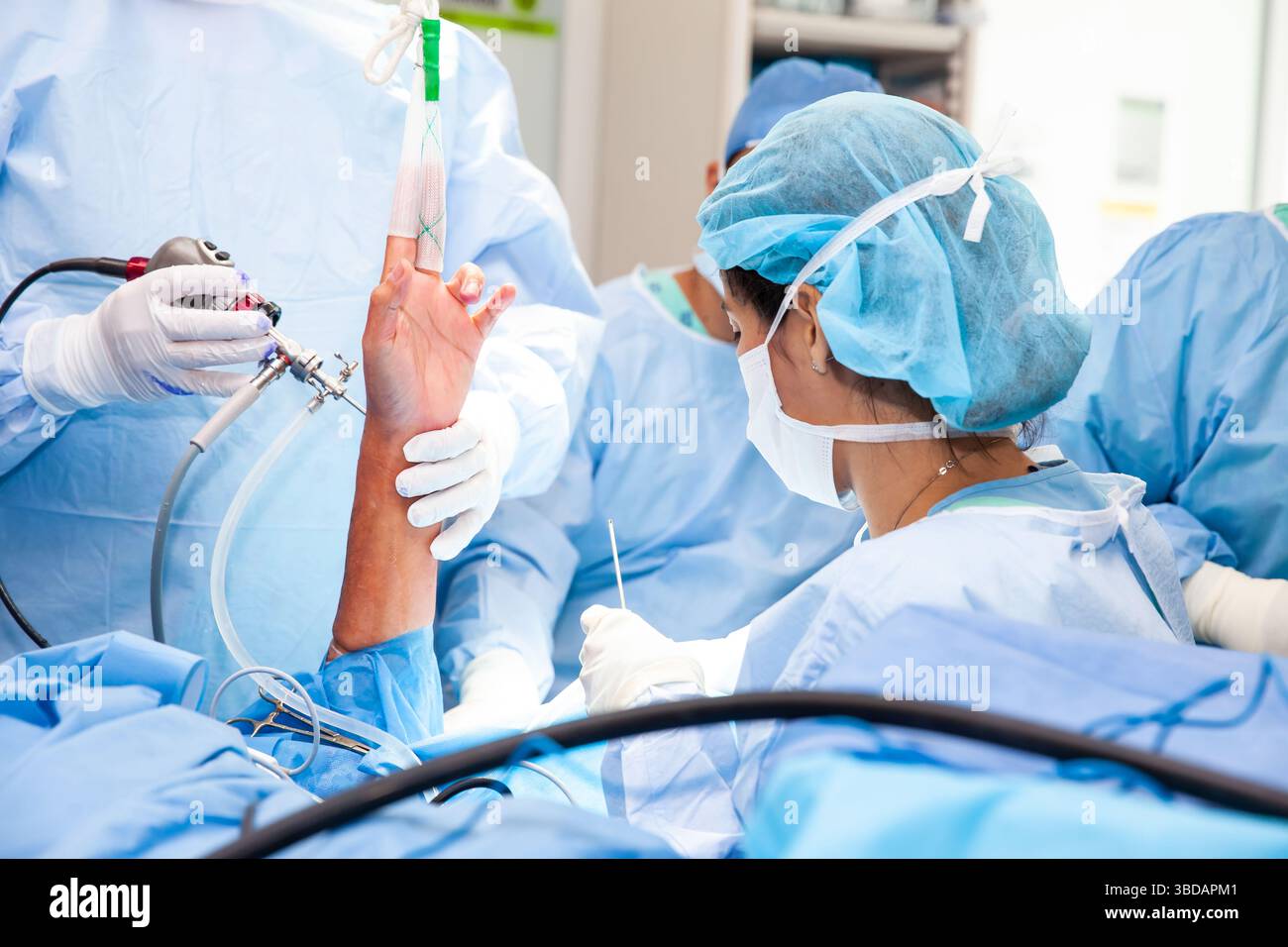 Group of orthopedic surgeons performing a wrist arthroscopy on a male ...