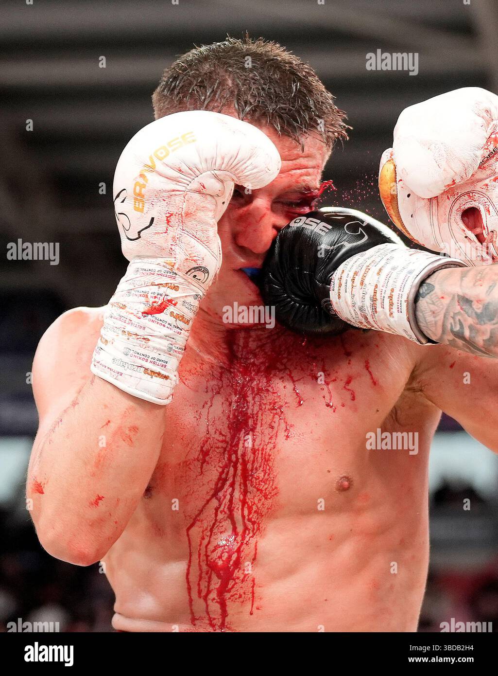 *EDITORS NOTE: BLOOD* Lewis Sylvester lands a punch on Reece Mould ...