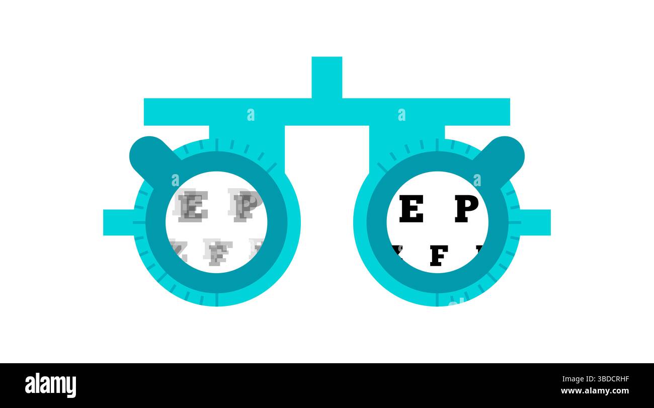 Illustration of amblyopia, also called lazy eye. This is reduced vision ...