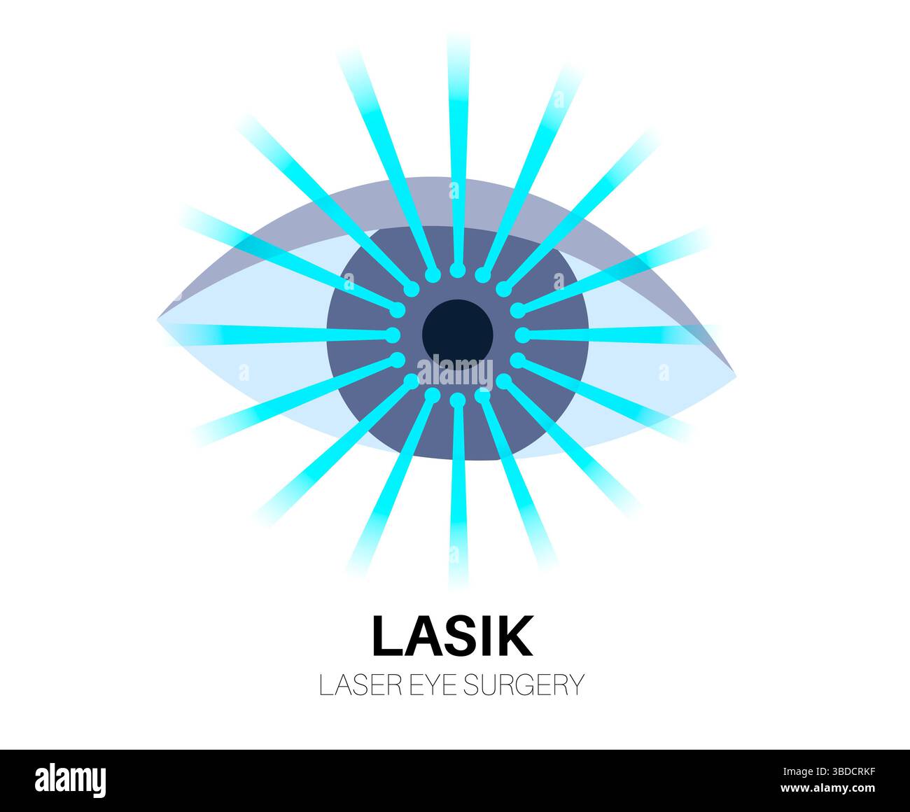 Conceptual illustration of LASIK also known as laser eye surgery. This ...