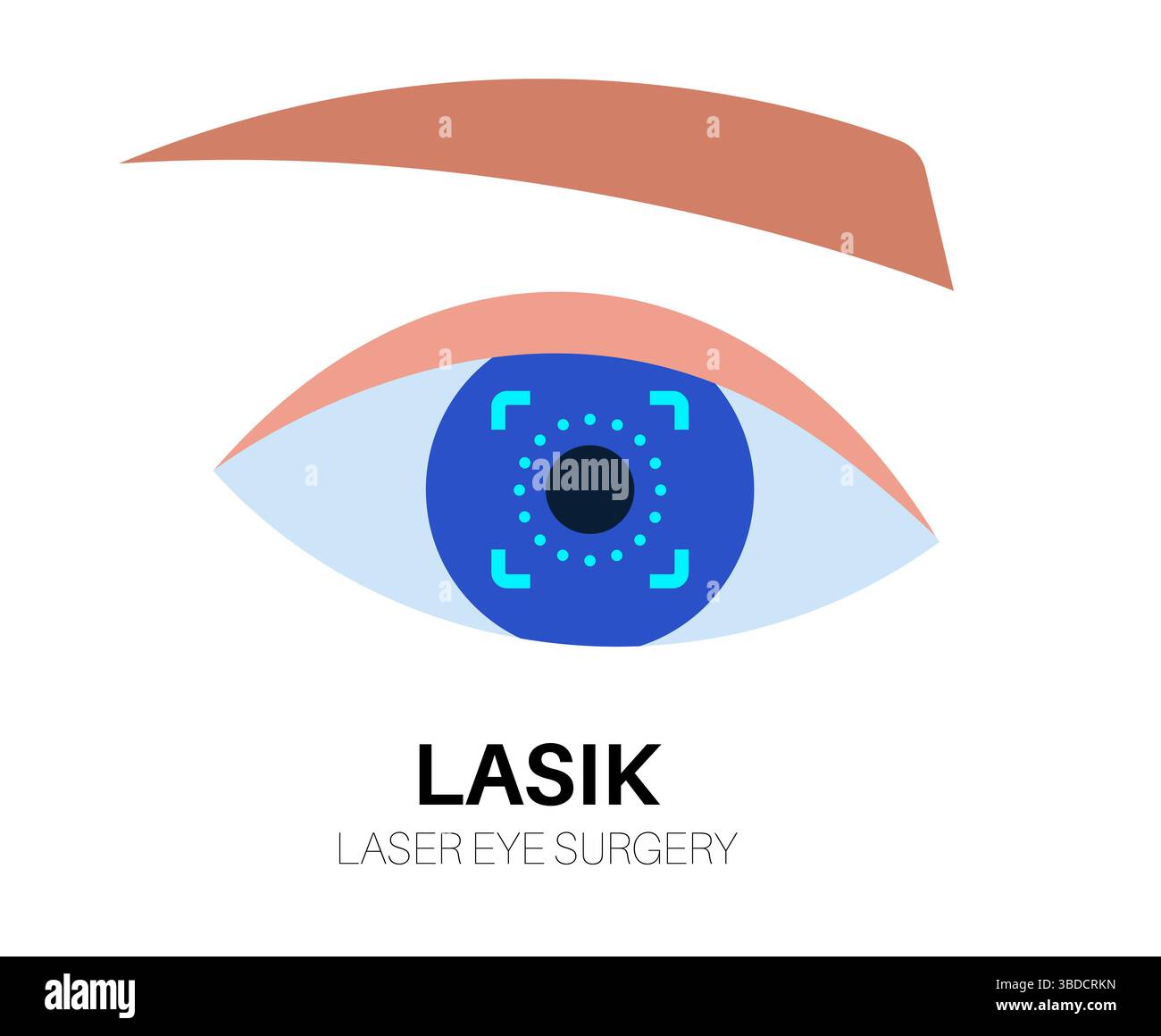 Conceptual illustration of LASIK also known as laser eye surgery. This ...