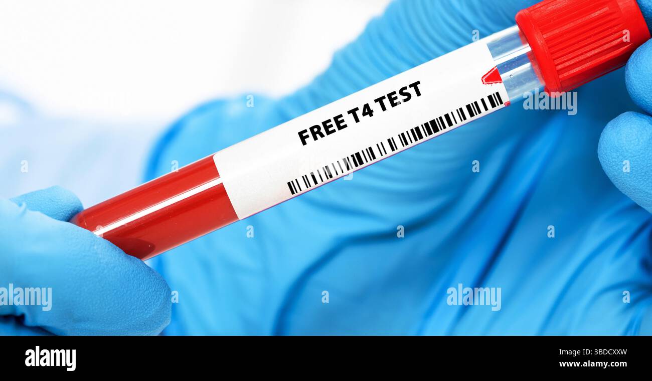 Free thyroxine (T4) test. Measures free T4 levels to evaluate thyroid ...