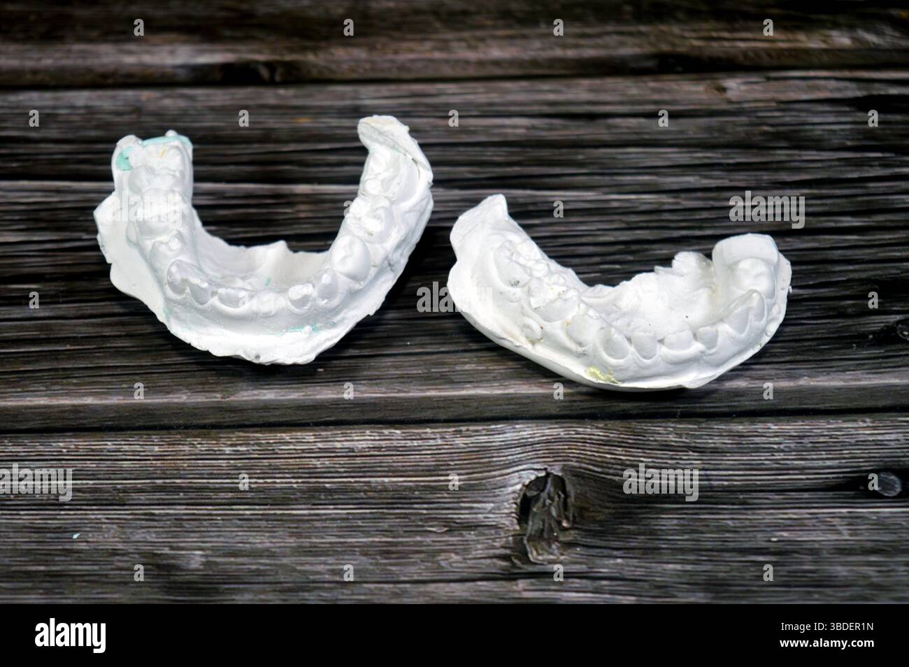 Dental cast model made from impression (a negative imprint of the teeth ...