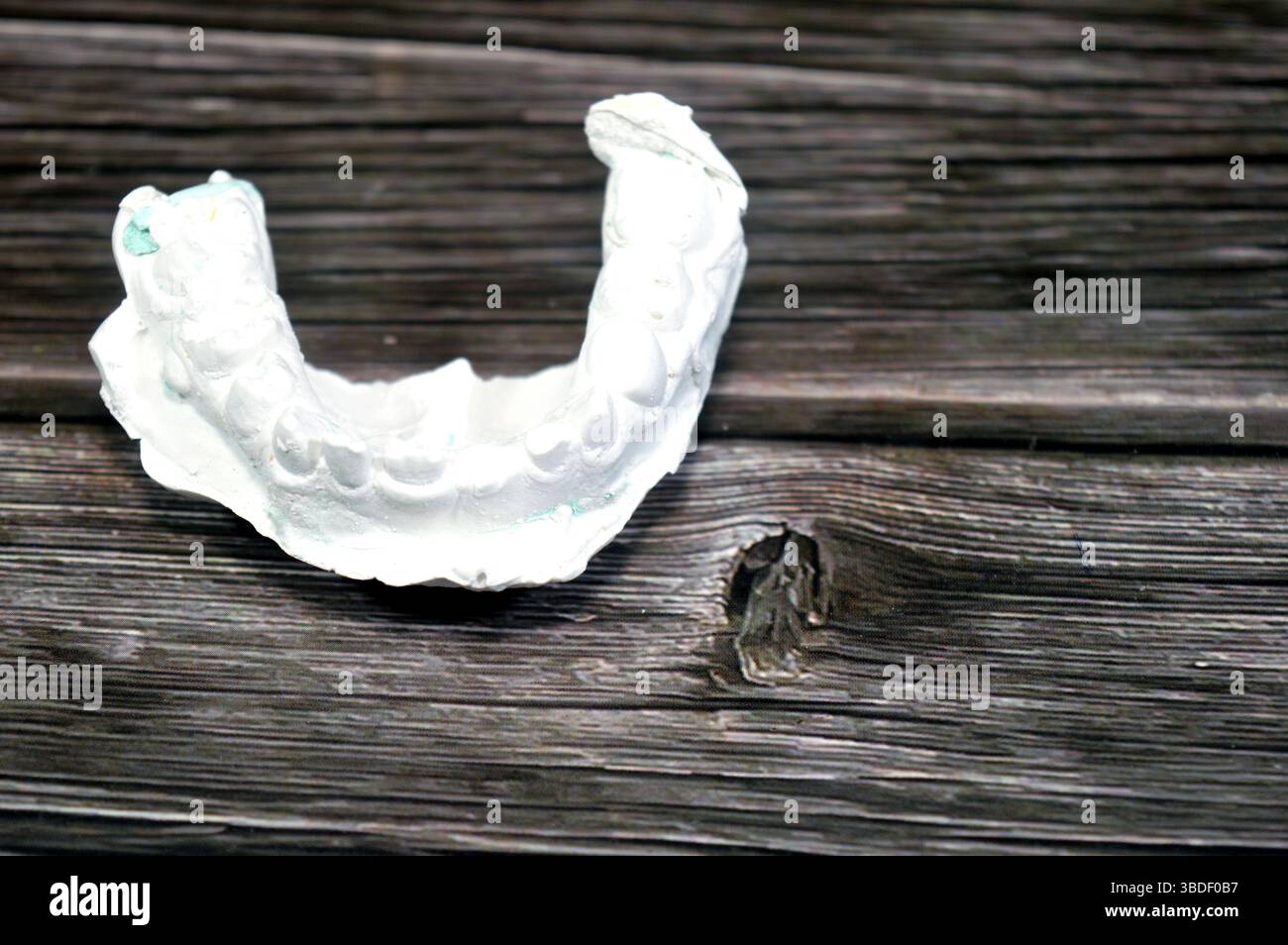 Dental cast model made from impression (a negative imprint of the teeth ...
