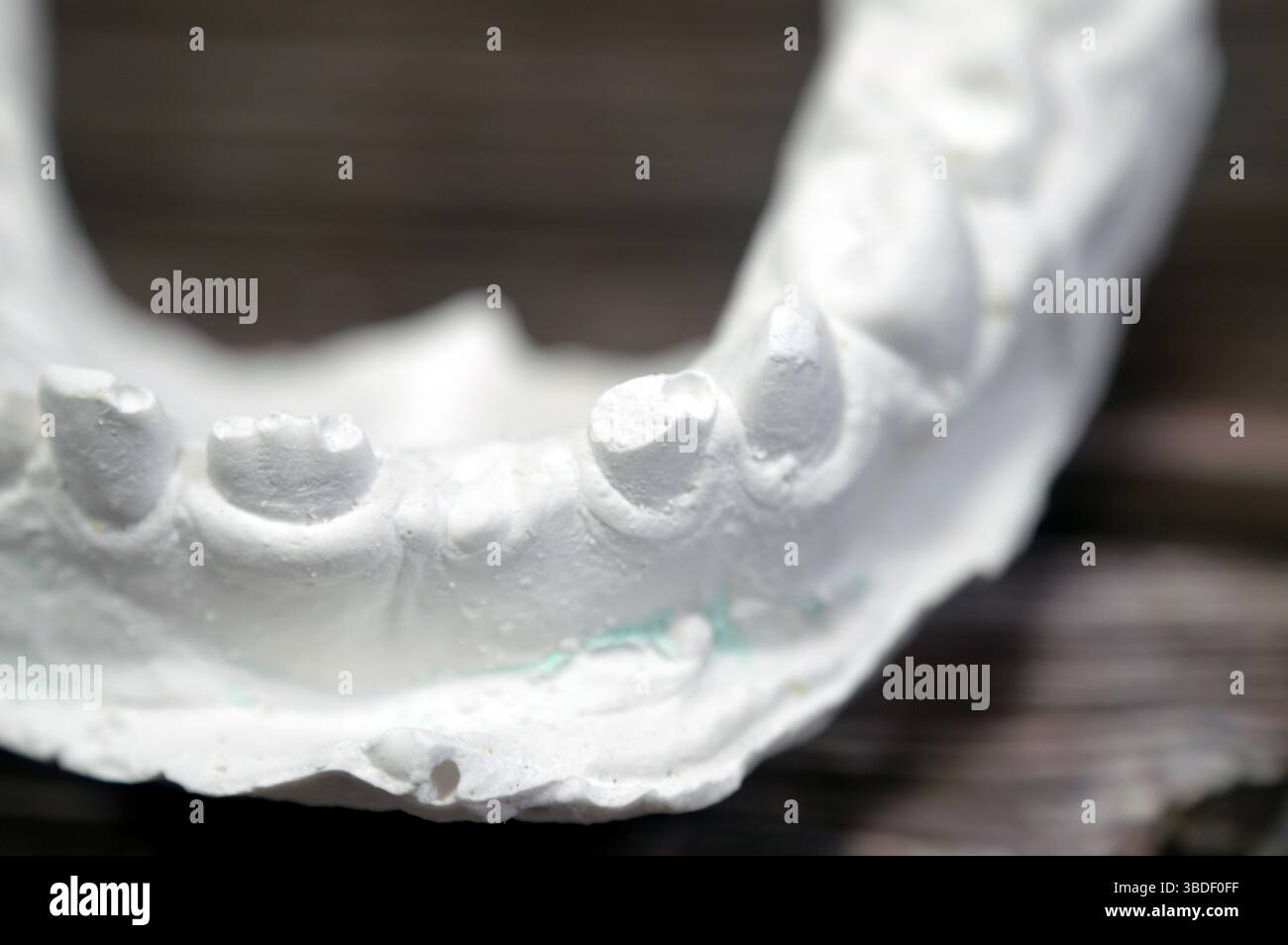 Dental cast model made from impression (a negative imprint of the teeth ...