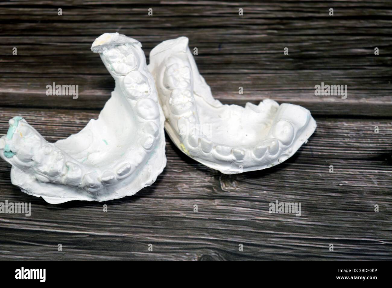 Dental cast model made from impression (a negative imprint of the teeth ...