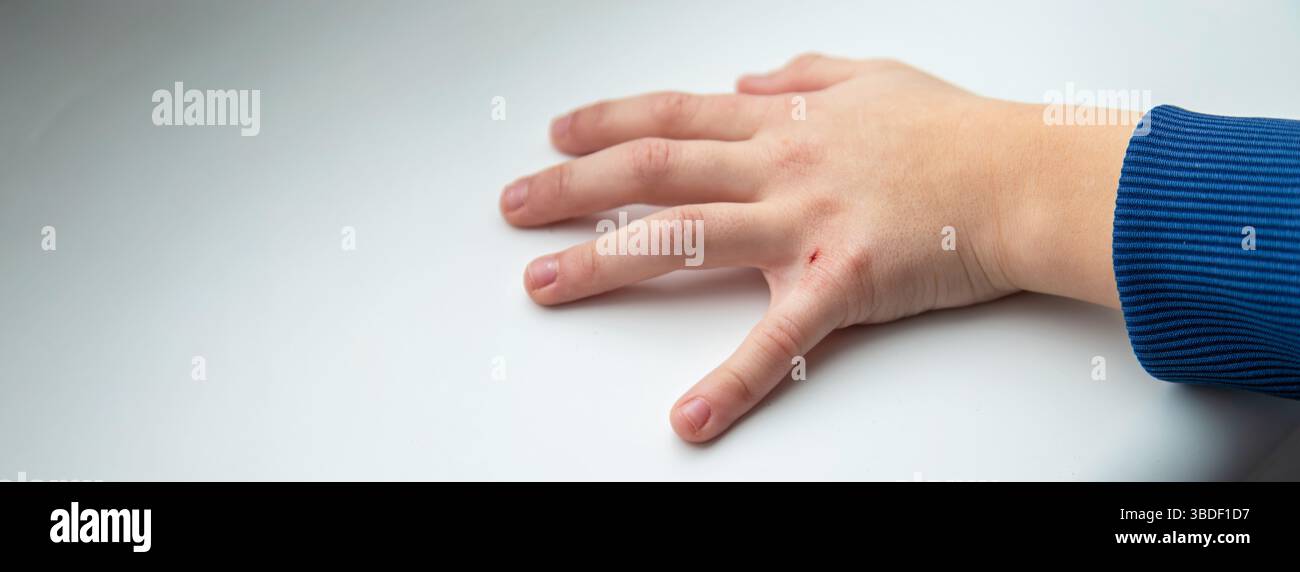 Skin rashes, allergies contact dermatitis ,allergic to chemicals ...